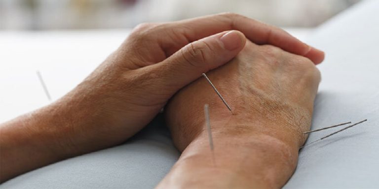 What Is Acupuncture and How Does it Work